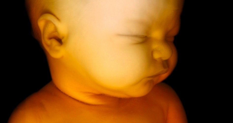 Canadian Medical Association Redefines Human Life - The New American